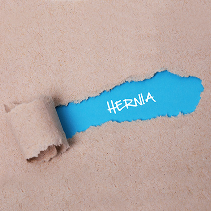 What is a Hernia? The Symptoms and Treatments Explained | Nature's Best